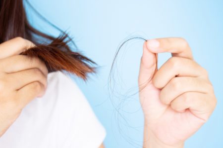 SOS: My Hair is Falling Out and I Don't Know What to Do